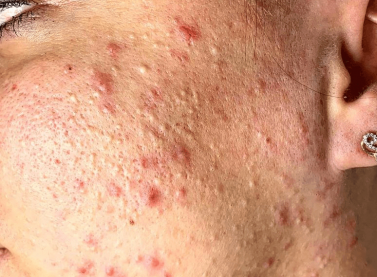 Skin Clinic in Melbourne | Cosmetic Medical Clinic Melbourne | Bay ...