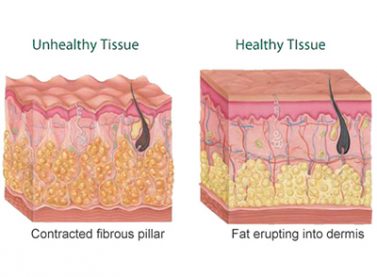 Cosmetic & Aesthetic Clinic in Melbourne| Bay Medical Aesthetics