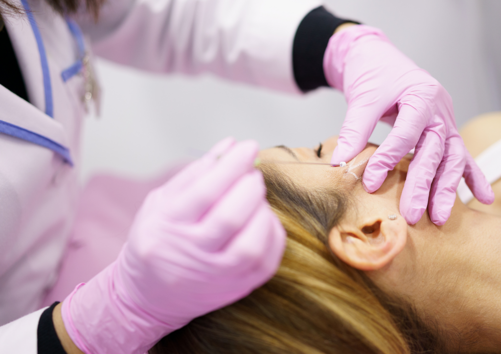 Face Lift Threading in Bayside, Melbourne | Bay Medical Aesthetics